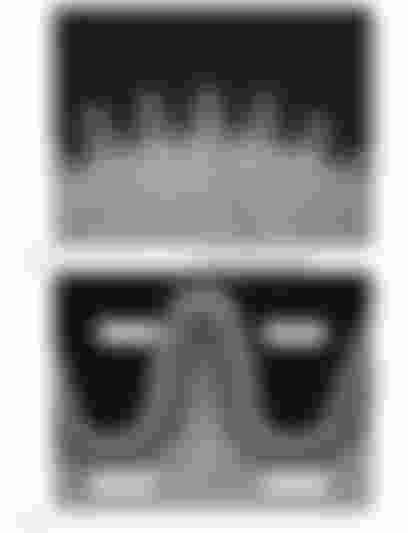 Carburizing | Metallurgical Solutions, Inc.